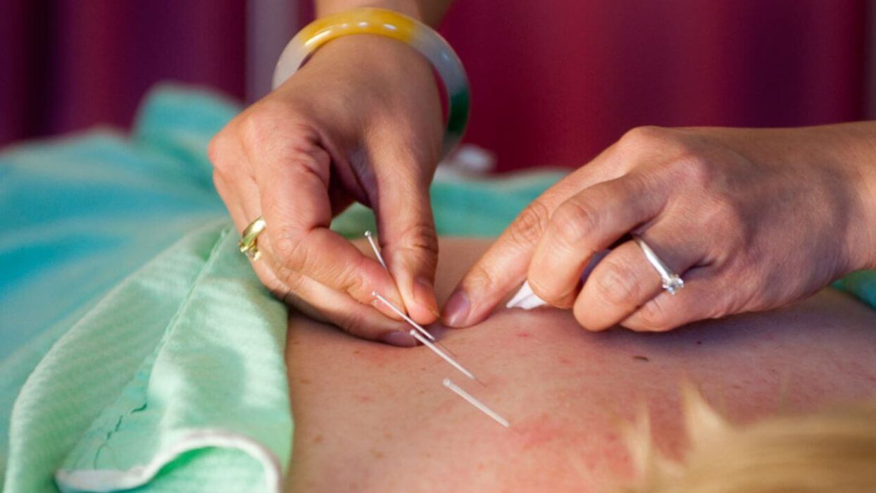 Working in a Hospital System as an Acupuncturist