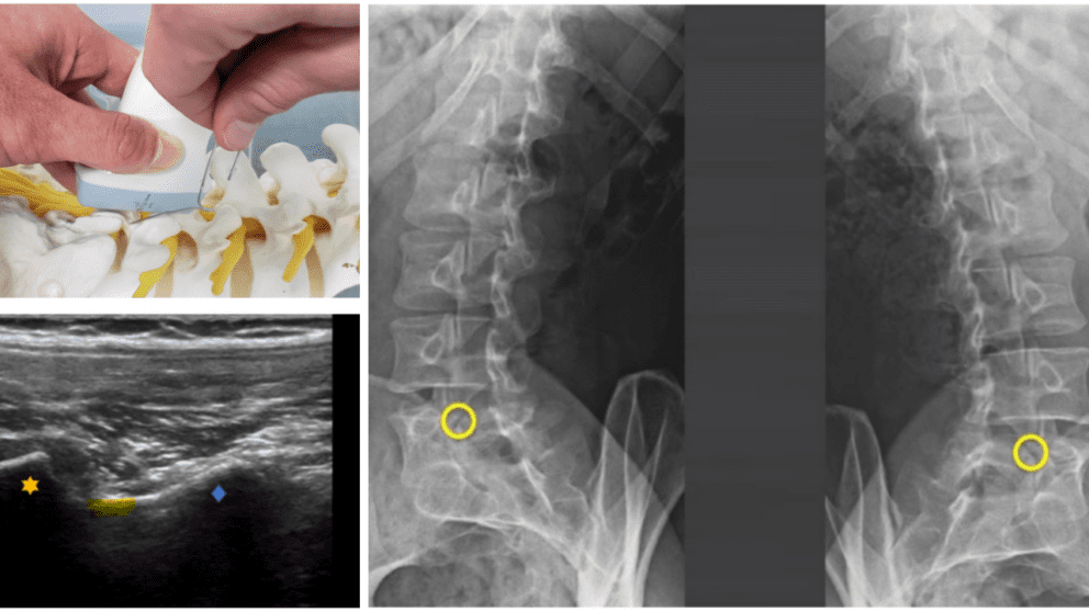 Dr. Smoley Publishes First-of-its-Kind Ultrasound Research